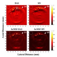 Biomedical Optics Express