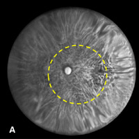 Biomedical Optics Express