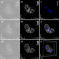 Biomedical Optics Express