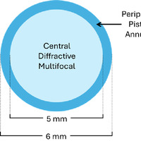 Biomedical Optics Express