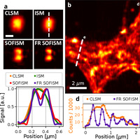 Biomedical Optics Express