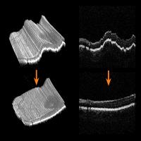 Biomedical Optics Express