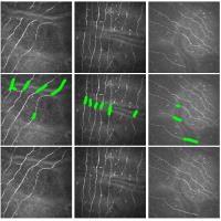 Biomedical Optics Express