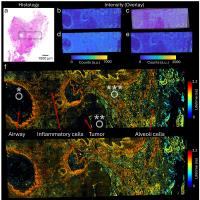Biomedical Optics Express