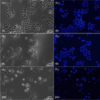 Biomedical Optics Express