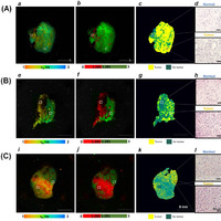 Biomedical Optics Express